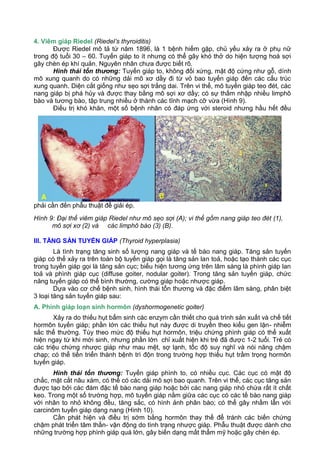 BỆNH LÝ TUYẾN GIÁP | PDF