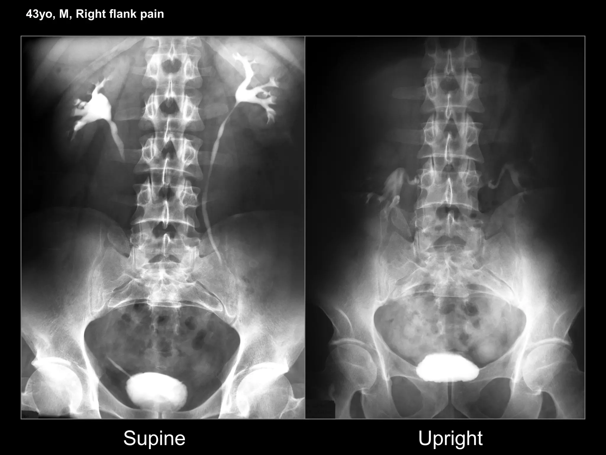 Bno ivp erect | PPT | Medical Tests | Medical Health