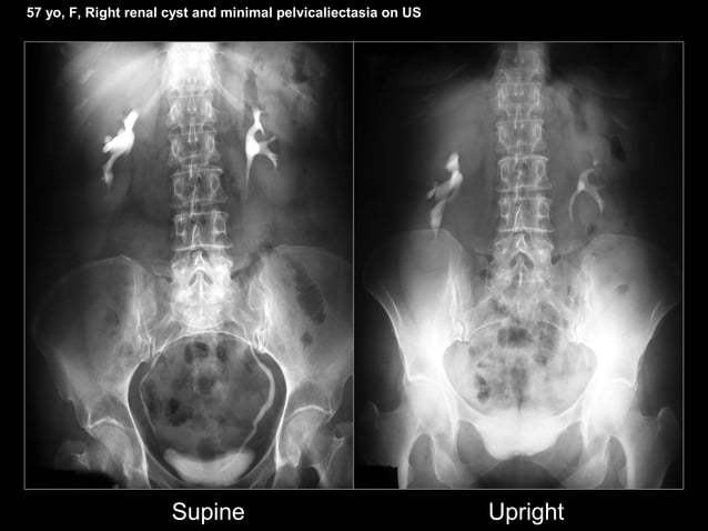 Bno ivp erect | PPT | Medical Tests | Medical Health