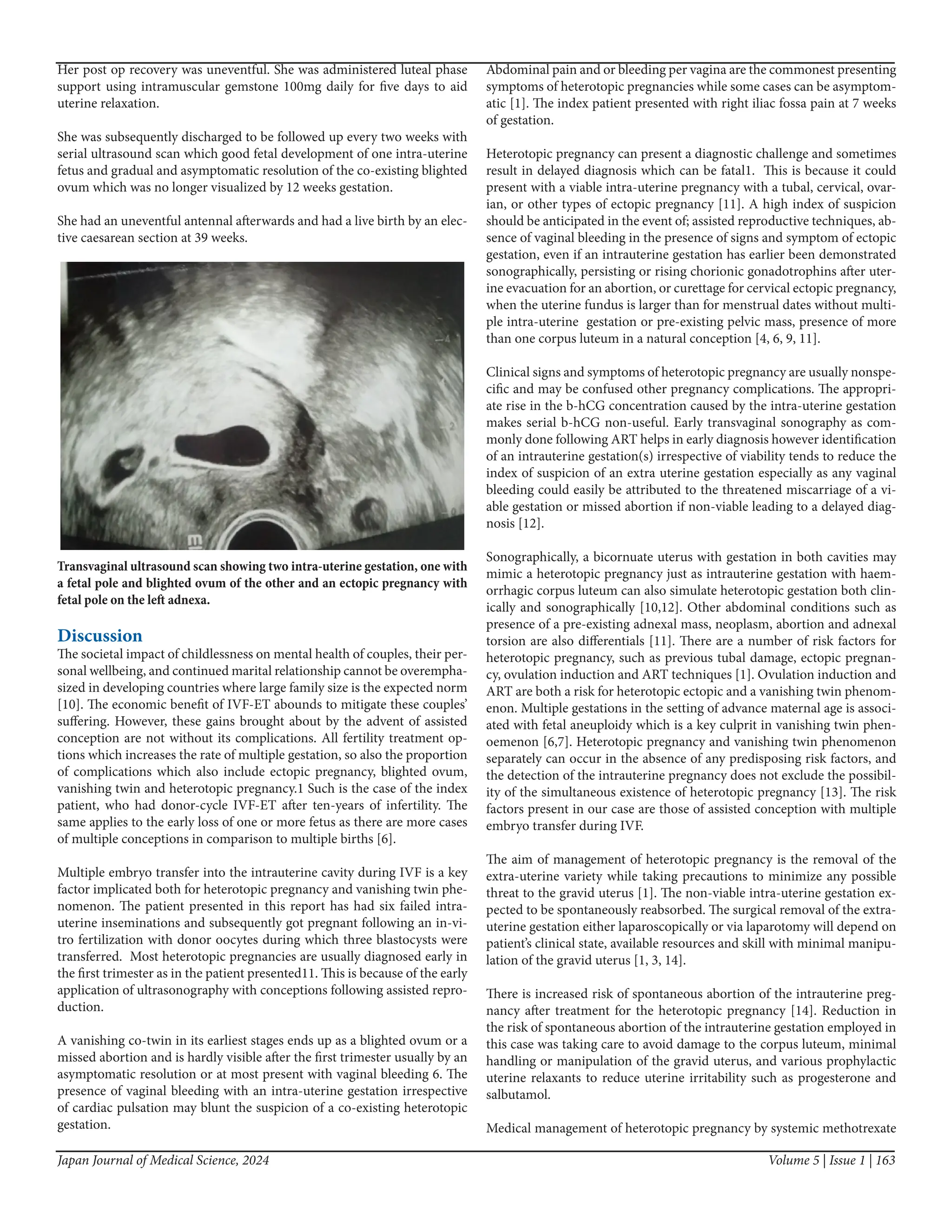 Blighted Ovum, intrauterine viable gestation and Left Tubal ectopic ...