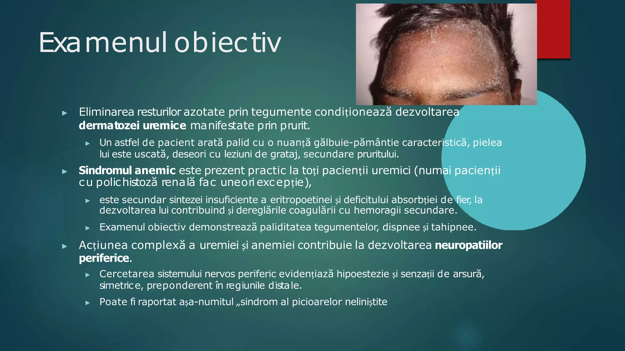 Boala Cronica Renala (BCR) (1).pptx