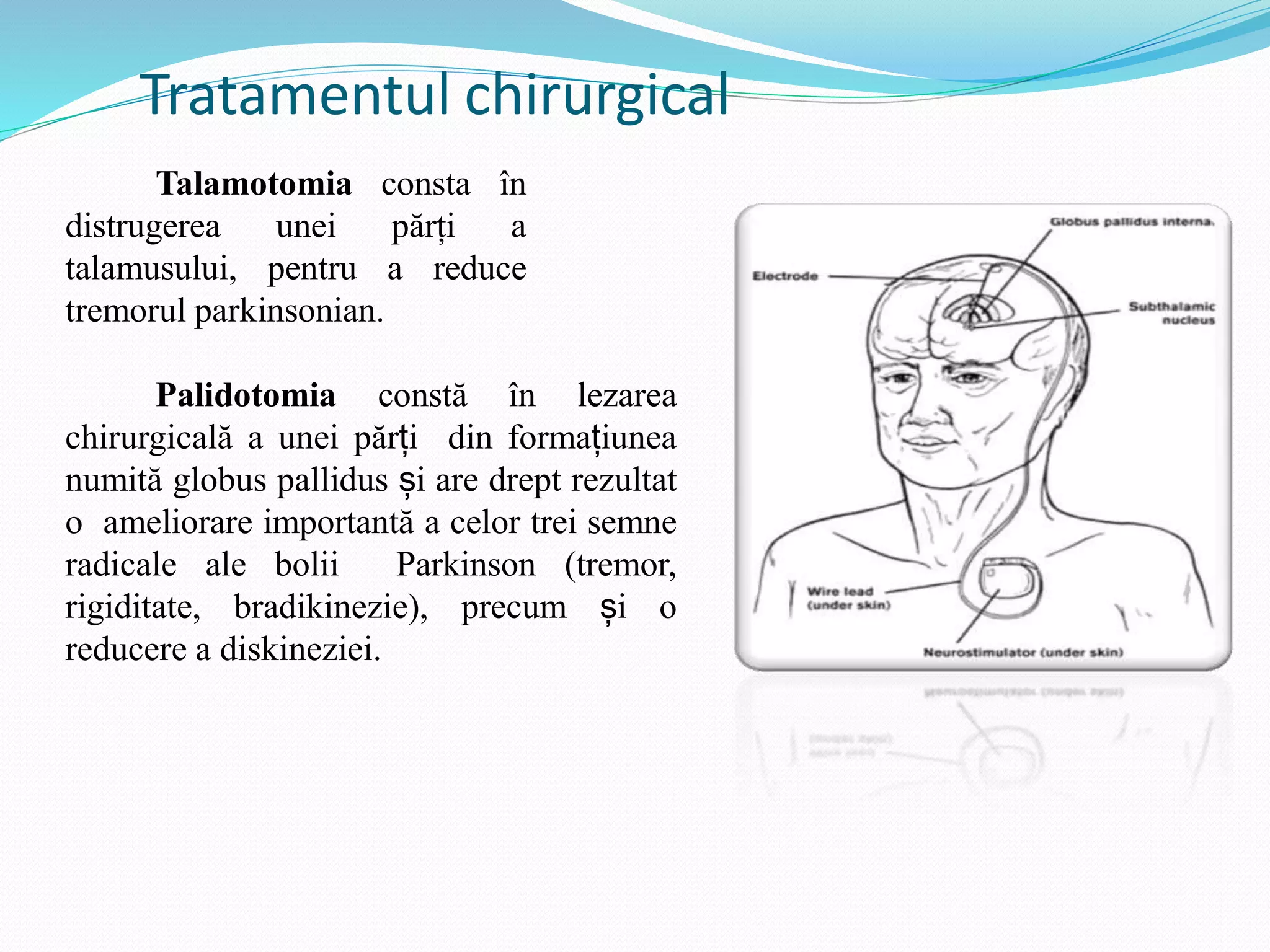 boala parkinson ppt.pptx