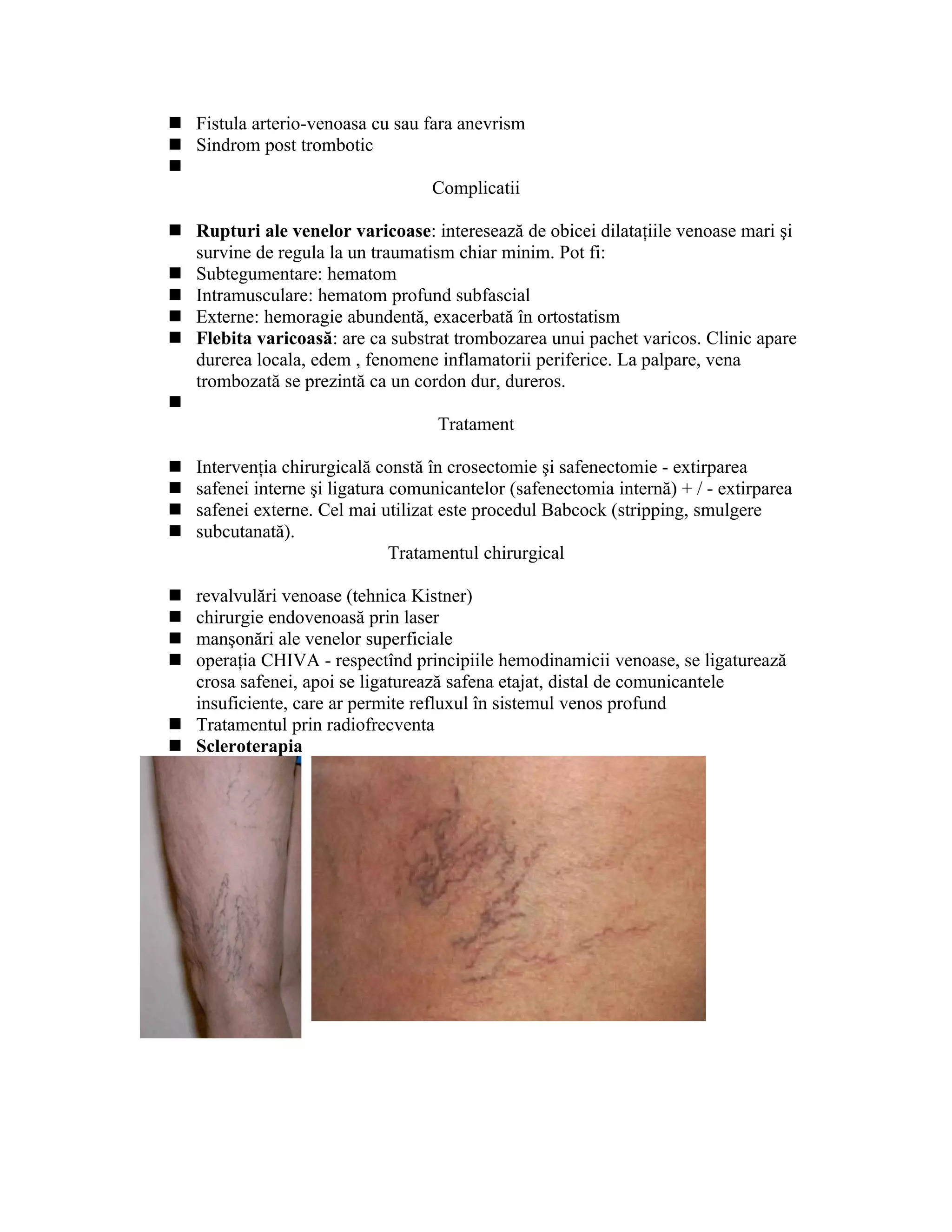 Boala varicoasa | DOC