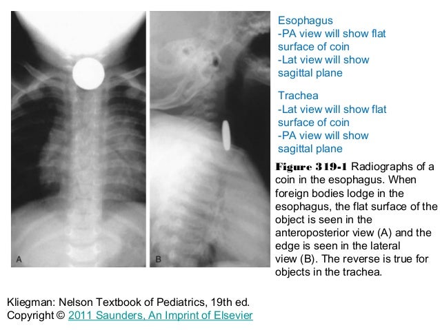 Board review abdomen 9.4.13