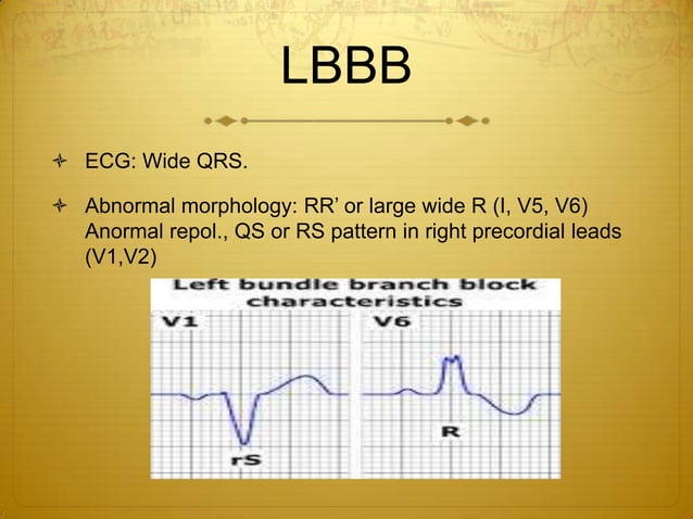 Arbi Ayvazian, DO- Valvular Disease, Conduction Disorders ...