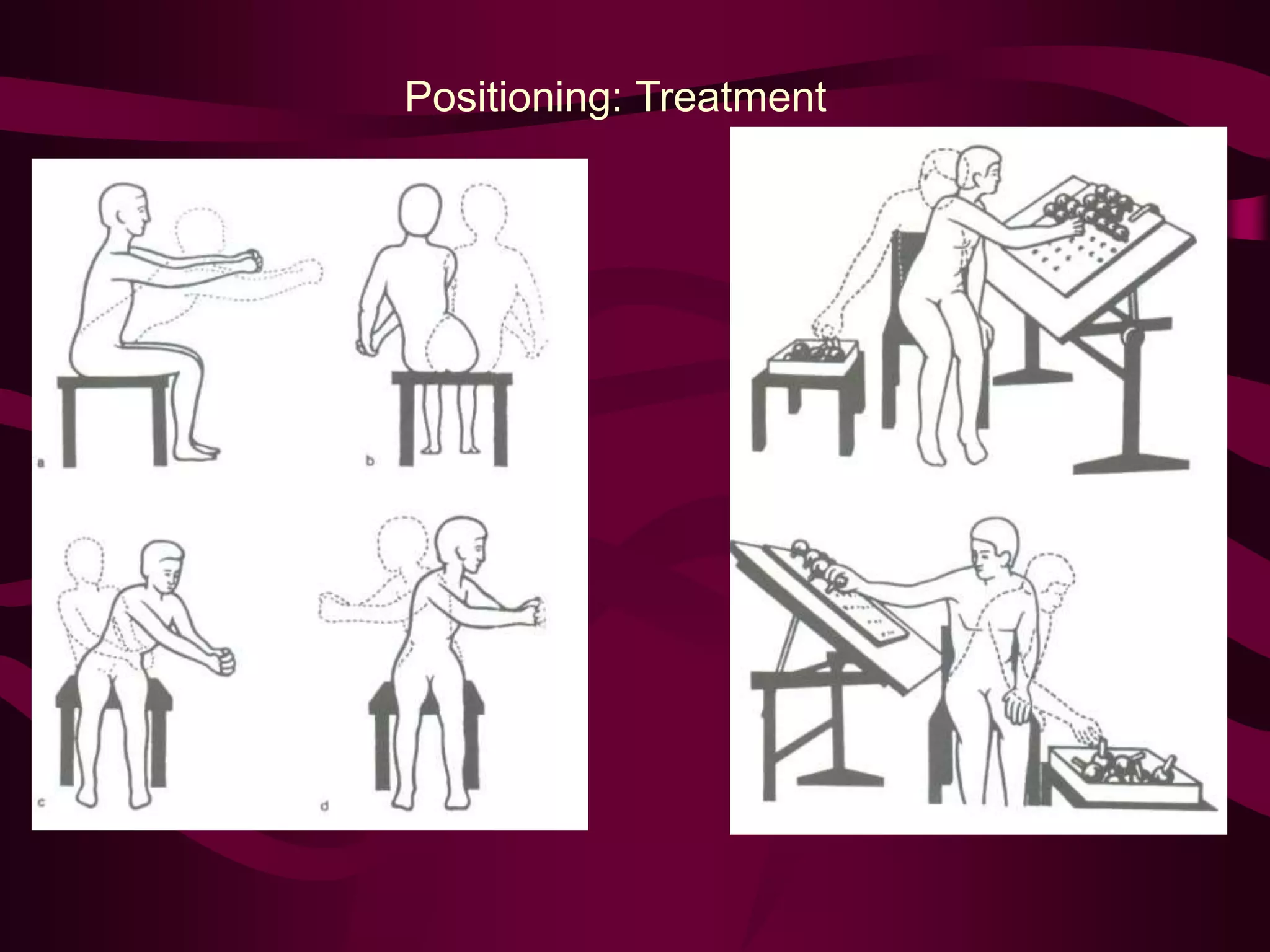 Bobath therapy.ppt
