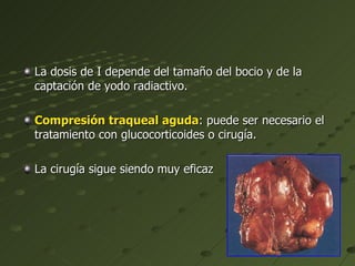 Bocio | PPT