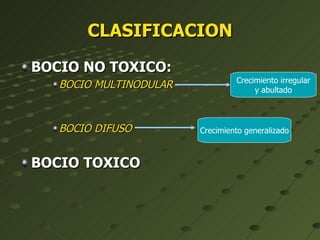 Bocio | PPT