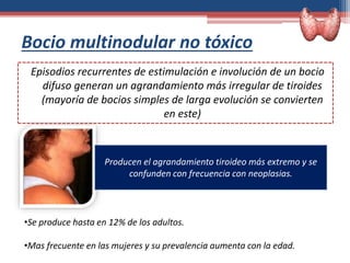 Bocio Ana M. Ibargüen | PPTX