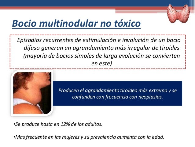 Bocio Ana M. Ibargüen