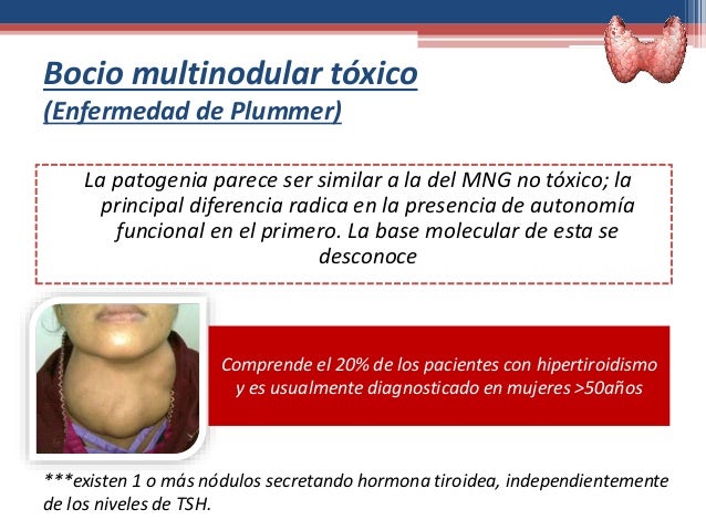 Bocio Ana M. Ibargüen