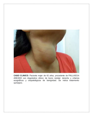 BOCIO NODULAR. | DOCX
