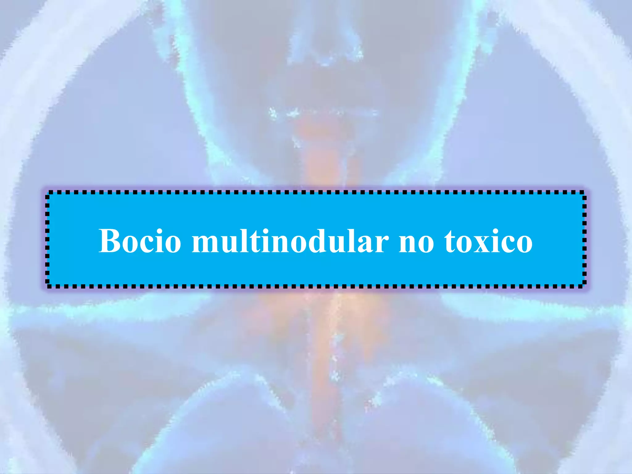 Bocio y enfermedad tiroidea nodular | PPT