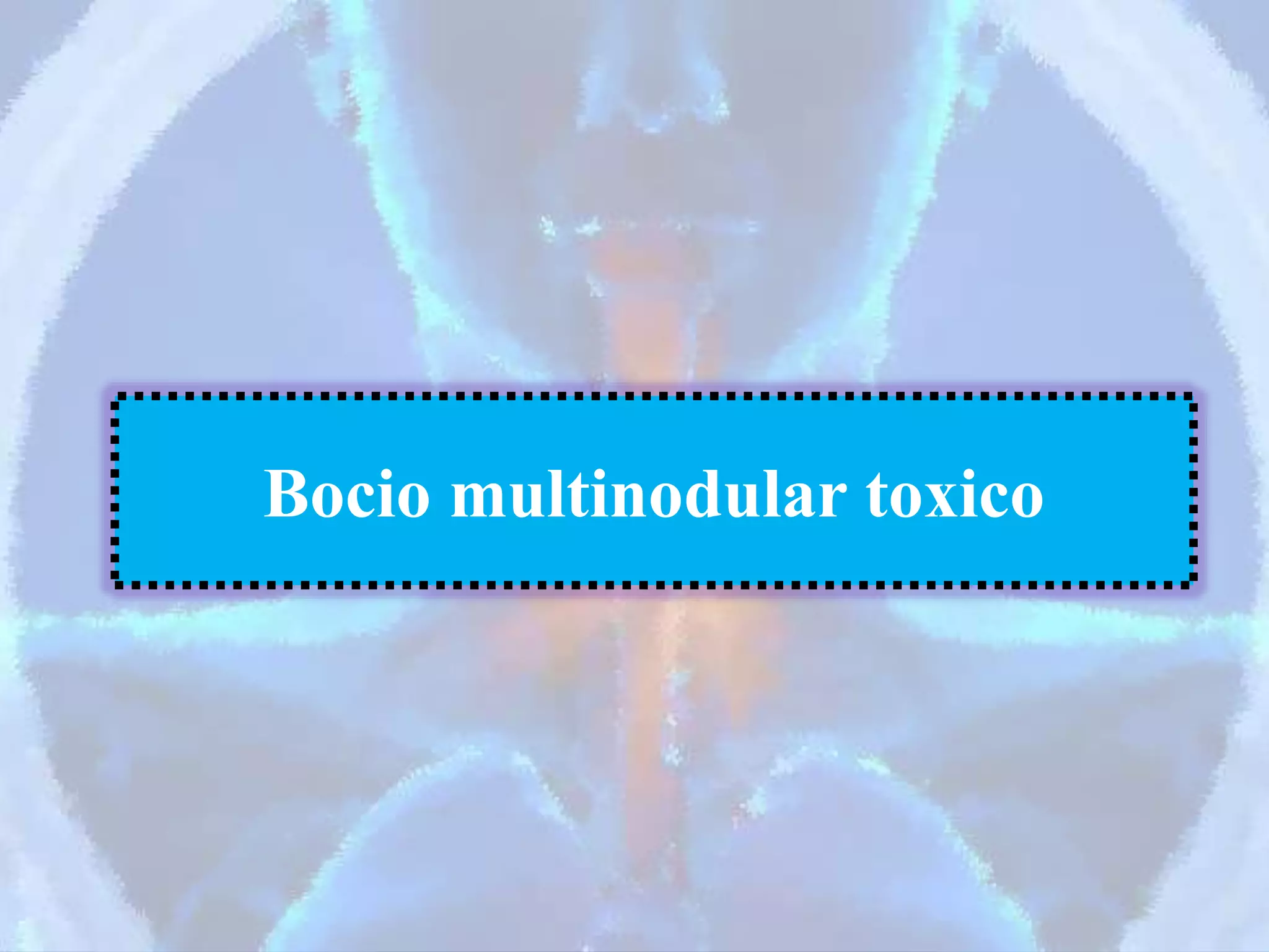 Bocio y enfermedad tiroidea nodular | PPTX