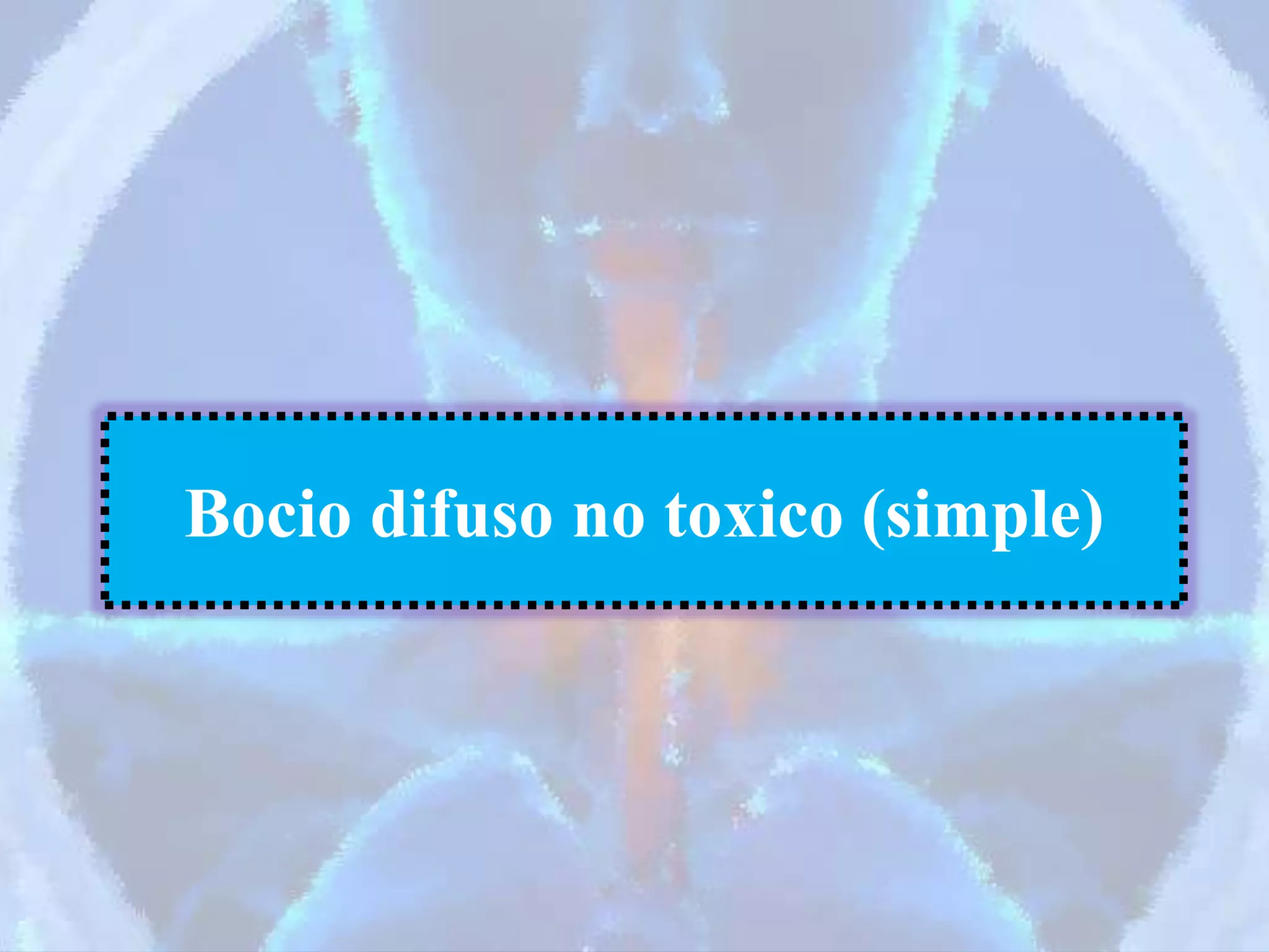 Bocio y enfermedad tiroidea nodular | PPT