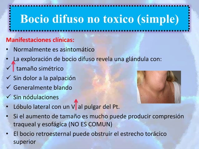 Bocio y enfermedad tiroidea nodular | PPTX