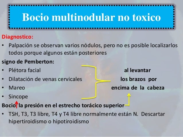 Bocio y enfermedad tiroidea nodular