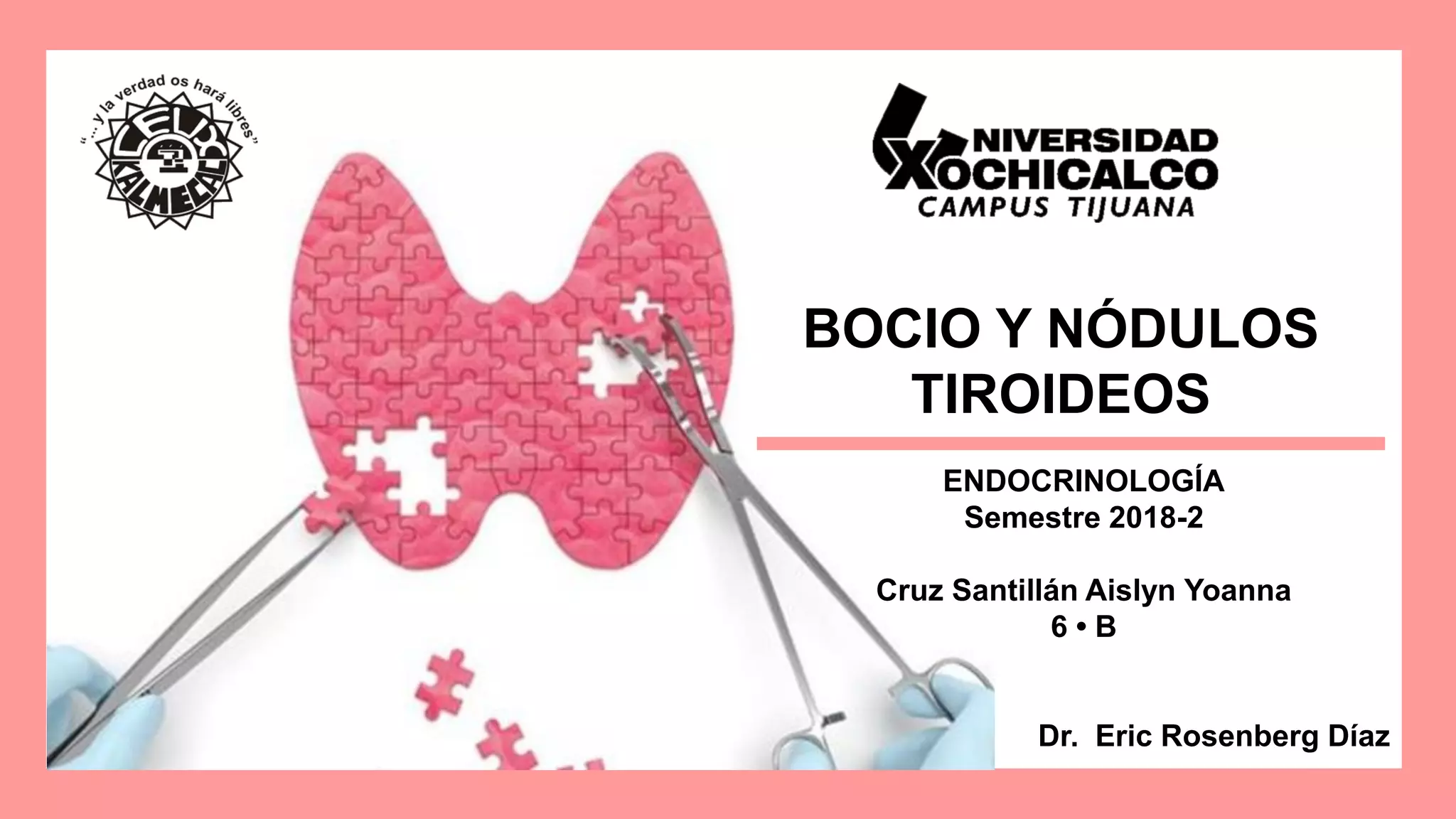 Bocio y nodulos tiroideos | PDF