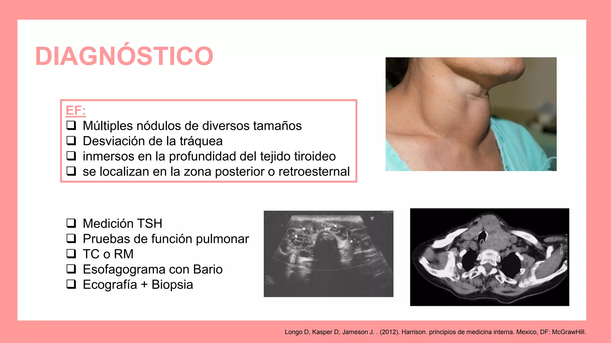 Bocio y nodulos tiroideos | PPT