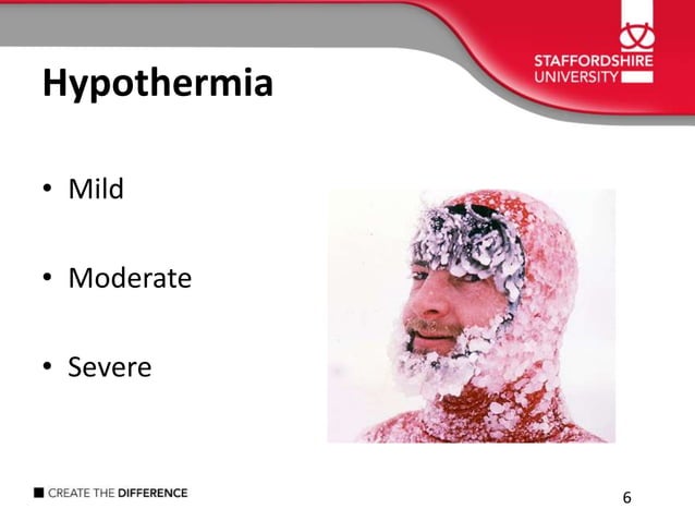 Body adaptations during exercise in extreme cold environment 1 1(1) | PPT