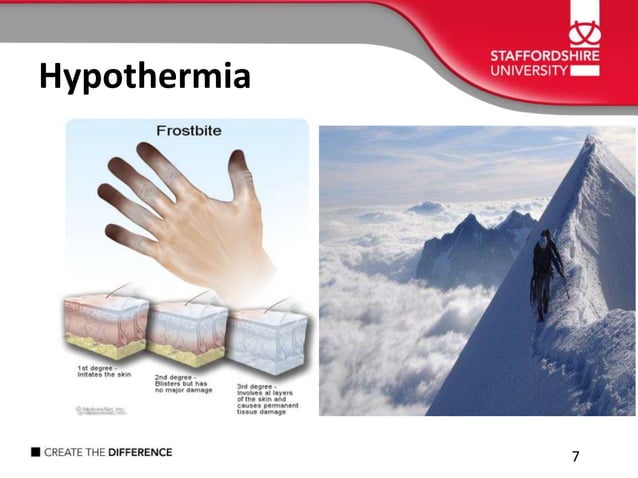 Body adaptations during exercise in extreme cold environment 1 1(1) | PPT