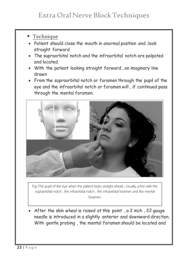 ExtraOral Nerve Block Techniques | DOCX
