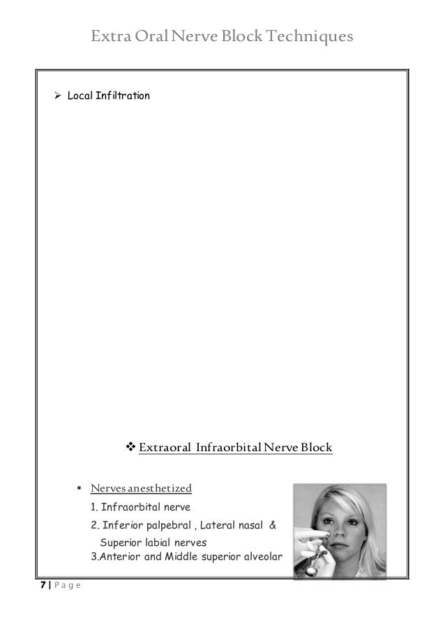 ExtraOral Nerve Block Techniques