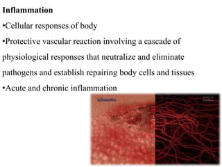 BODY DEFENSES AGAINST INFECTION.....pptx
