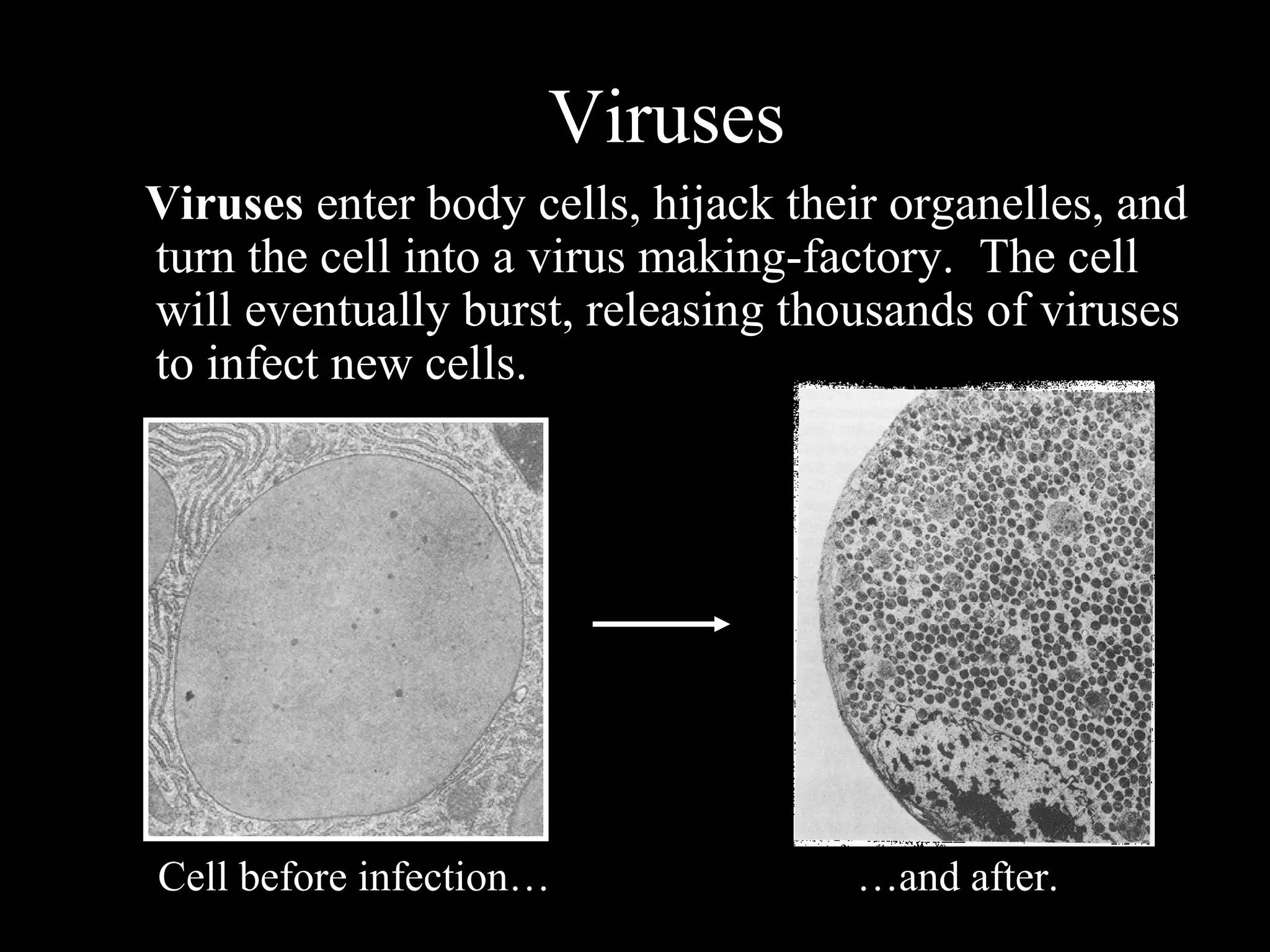 Body defenses against infection | PPT