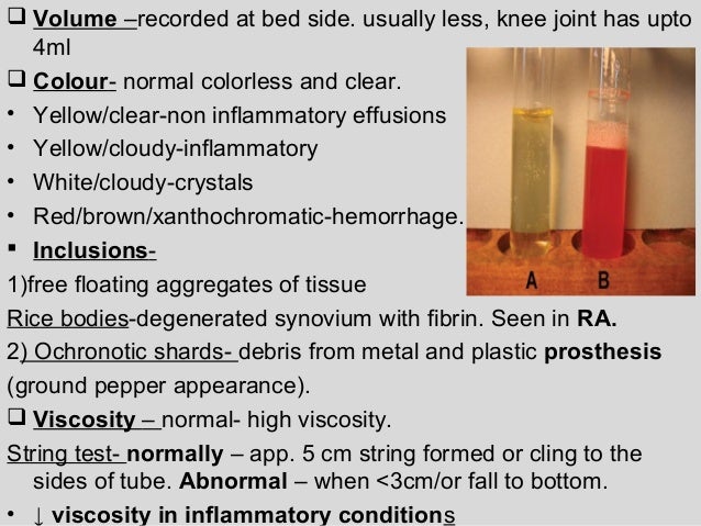 Body Fluid Analysis
