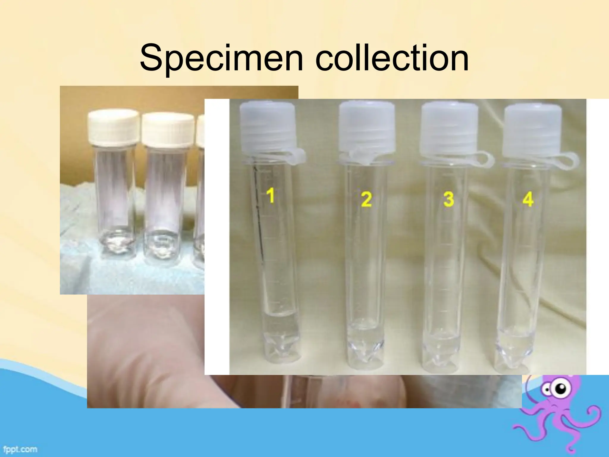 Body fluid analysis in clinically approved | PDF | Blood Disorders ...