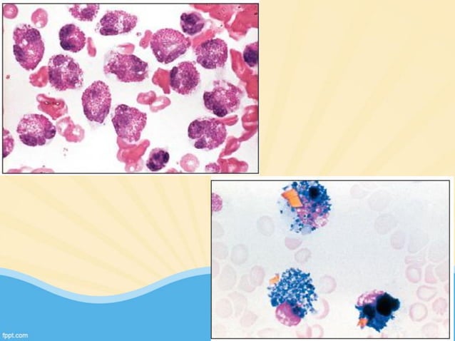Body fluid analysis in clinically approved | PDF | Blood Disorders ...