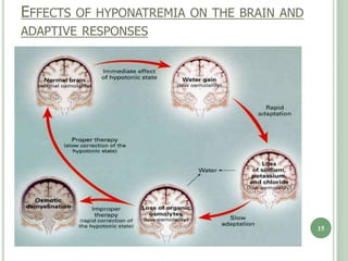 Body fluid, compartments and edema | PPTX