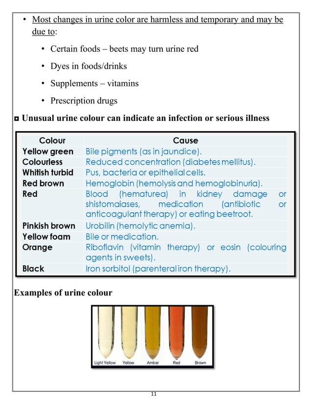 Body fluid ( the Urine ) Urinalysis | PDF | Blood Disorders | Diseases ...