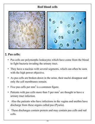 Urine Analysis and Kidney function tests | PDF