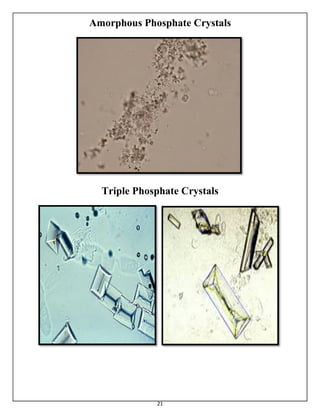 Urine Analysis and Kidney function tests | PDF
