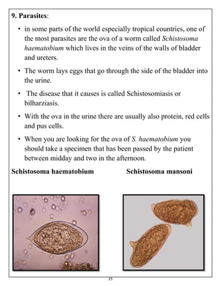 Urine Analysis and Kidney function tests | PDF