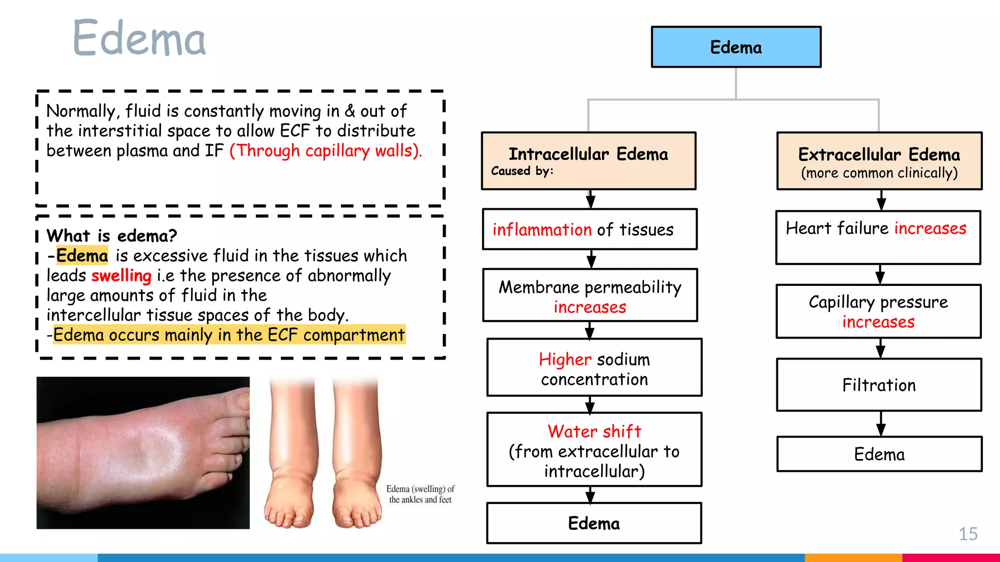 Body fluids and electrolytes+Edema.pdf