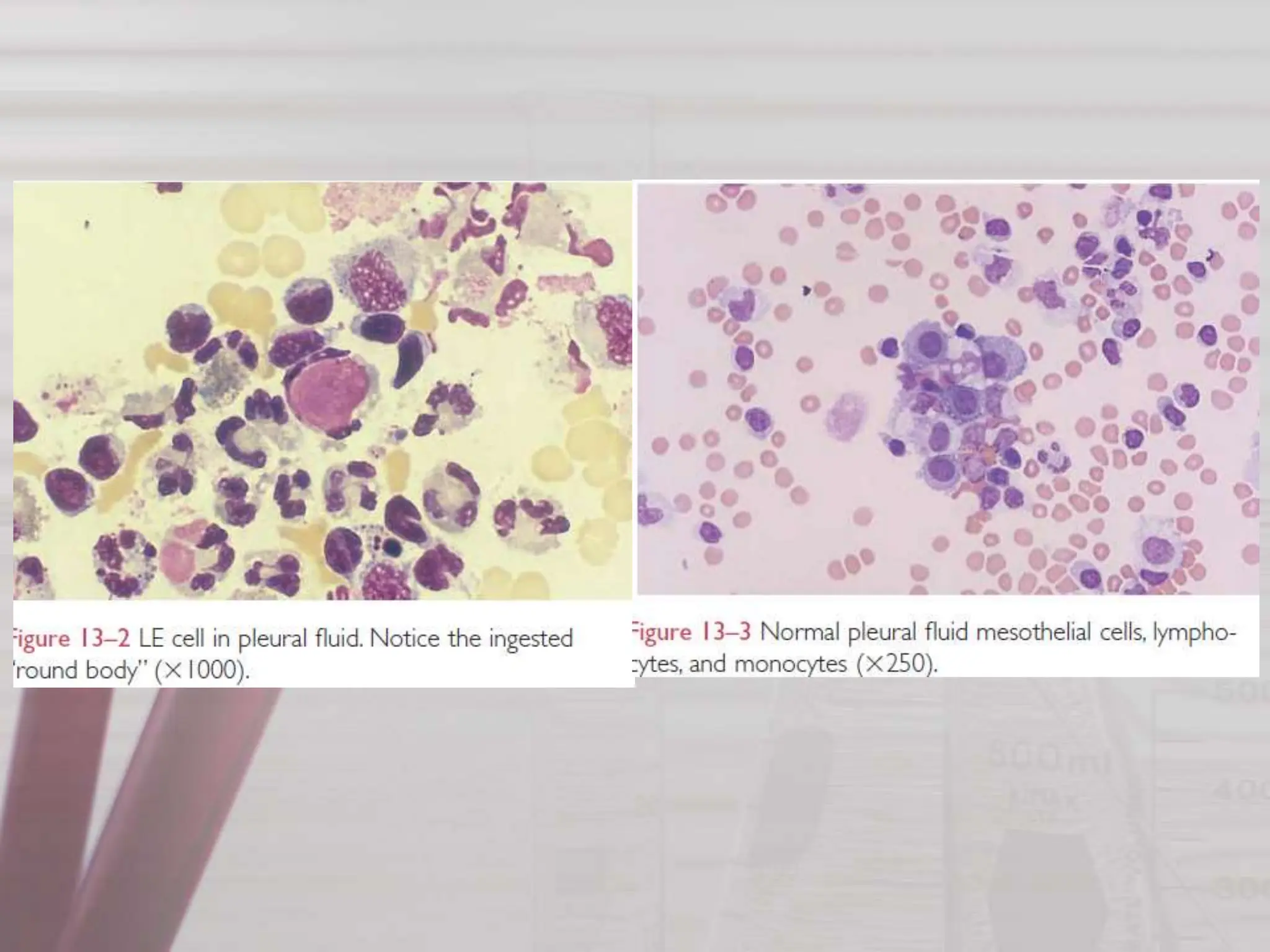 BODY FLUIDS AND SPUTUM ANALYSIS.pptx for mbbs and para medical | PPTX