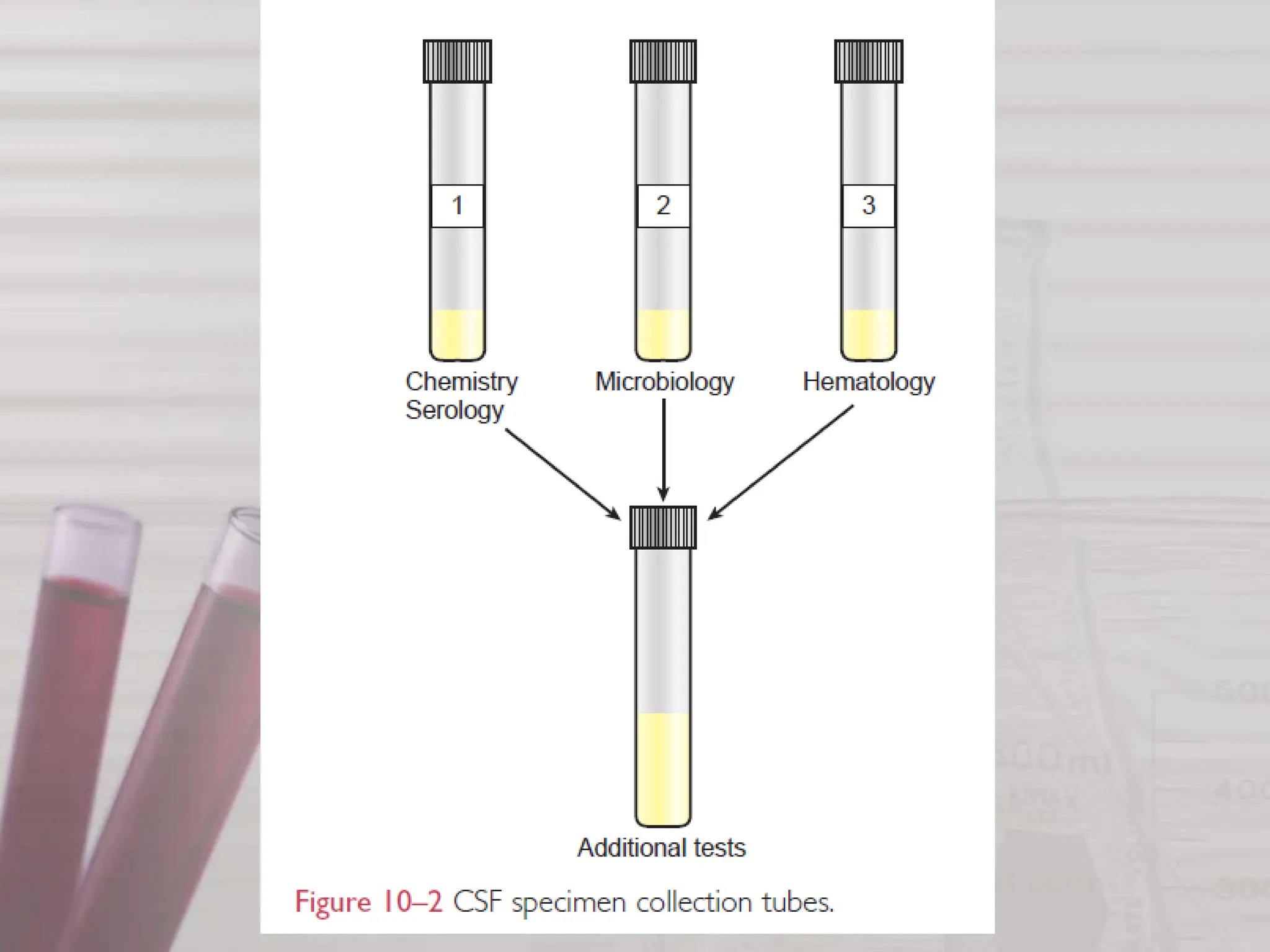 BODY FLUIDS AND SPUTUM ANALYSIS.pptx for mbbs and para medical | PPTX