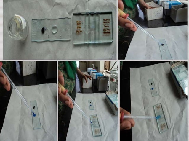 BODY FLUIDS AND SPUTUM ANALYSIS.pptx for mbbs and para medical | PPTX