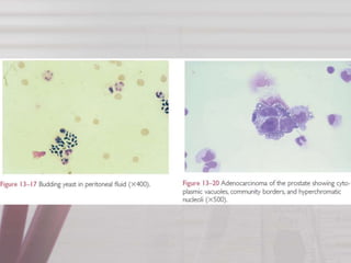 BODY FLUIDS AND SPUTUM ANALYSIS.pptx for mbbs and para medical | PPTX