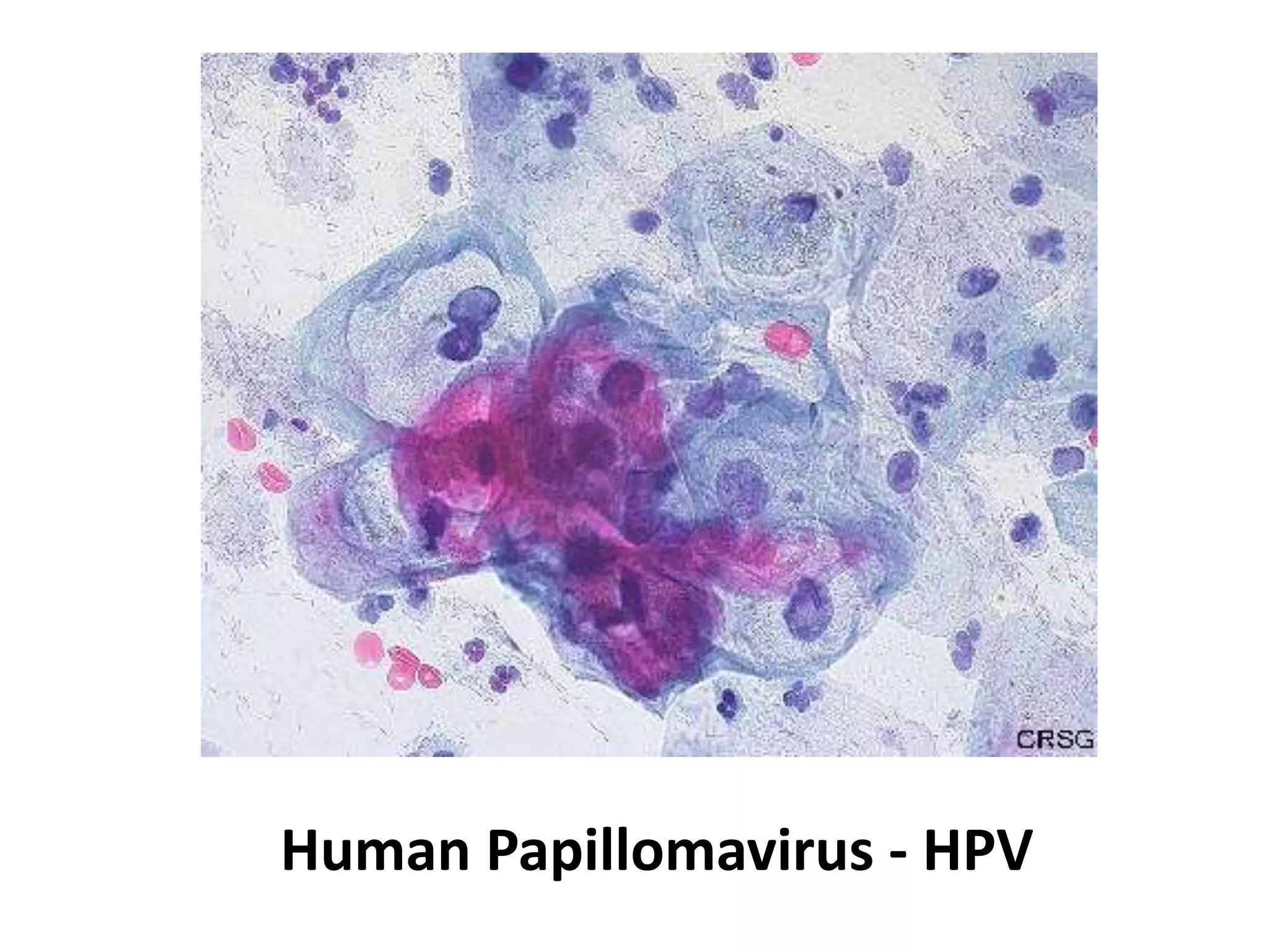 Body fluids, cervical pap | PPTX