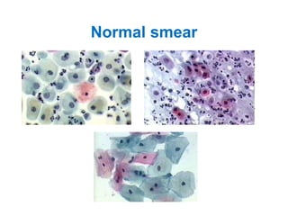 Body fluids, cervical pap | PPTX