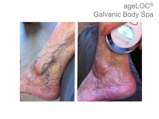 Body galvanic spa a narancsbőr mester | PPT