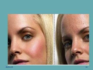 Body image presentation | PPT