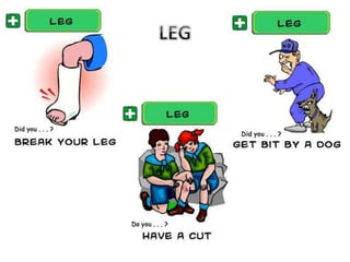 Body injuries | PPTX