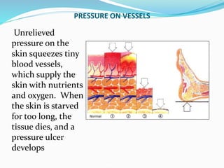 Body Mechanics, Positioning & Moving ..ppt
