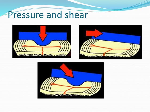 Body Mechanics, Positioning & Moving ..ppt