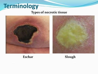 Body Mechanics, Positioning & Moving ..ppt